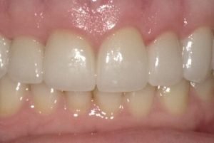 Springs Dental Group – Best Dentist Australia | Teeth Whitening ...